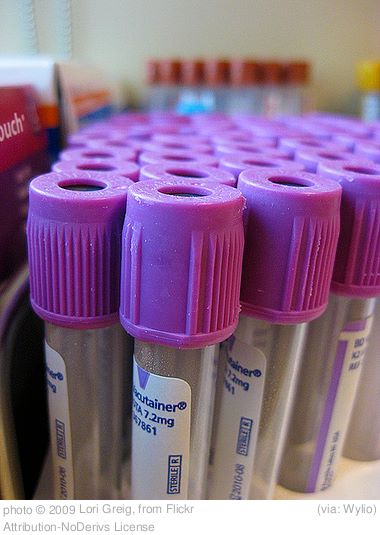 test vials - ClearHealthCosts