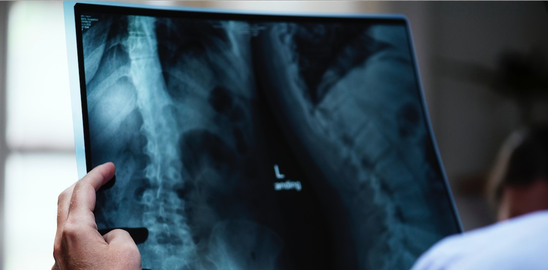 doctor holding x ray - ClearHealthCosts