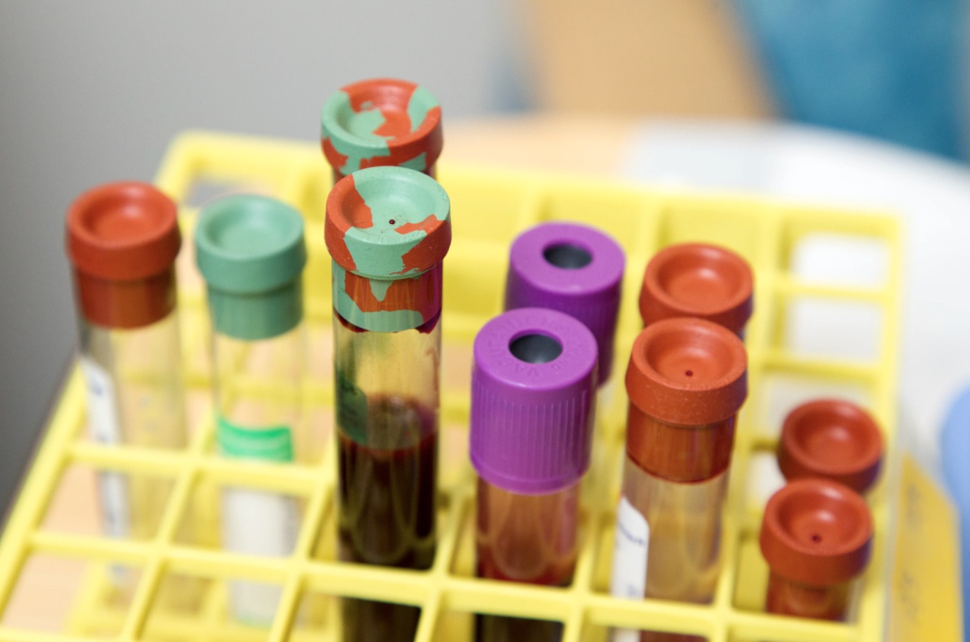 lab vial with blood - ClearHealthCosts