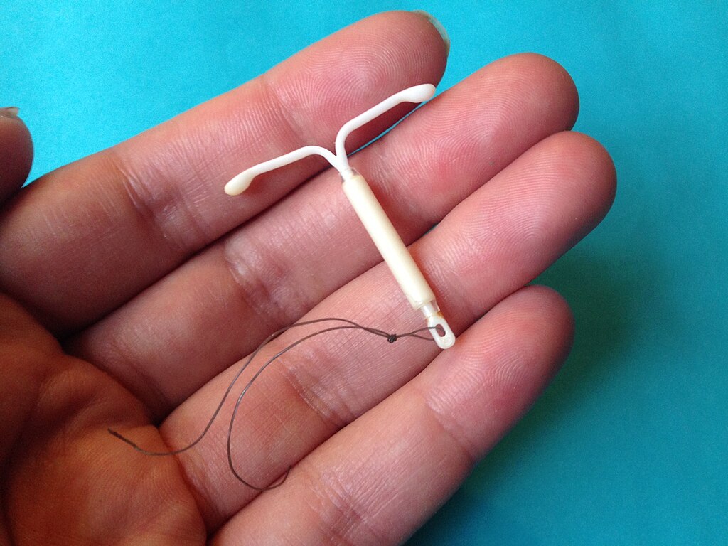 How much does an IUD cost? $0 or $500 or $2,600? And hey, is it covered ...